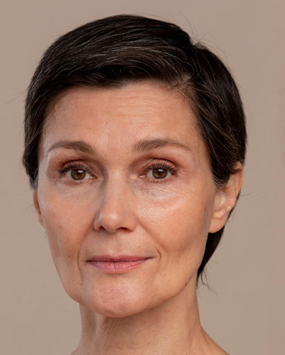 Facial Aesthetics - Dalkeith Dental Practice | Gentle & Modern Dentist ...